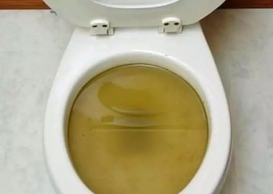 अवरुद्ध शौचालय